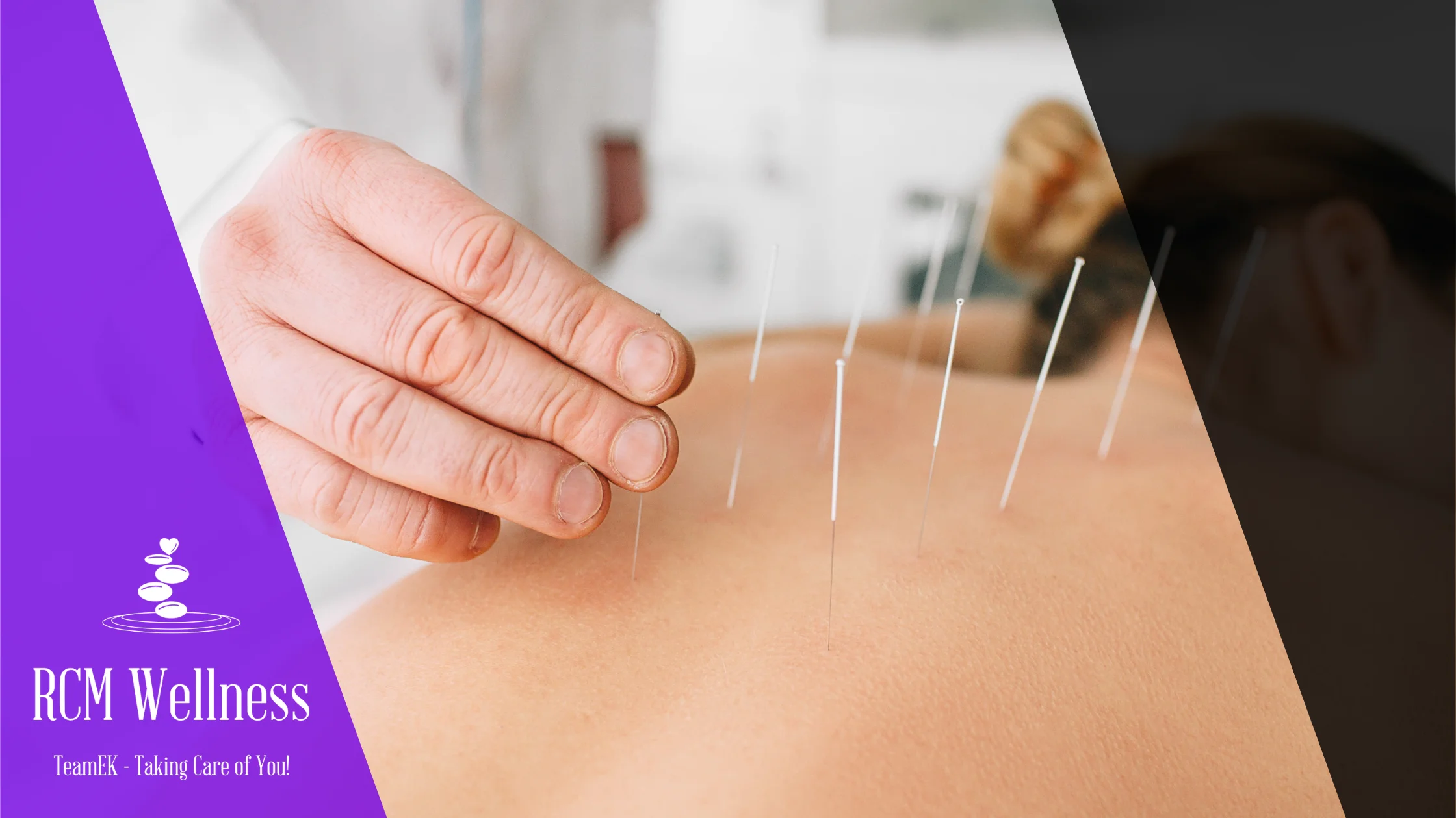 Acupuncture - Town Hall Dental | The North of England's Premier Dental ...