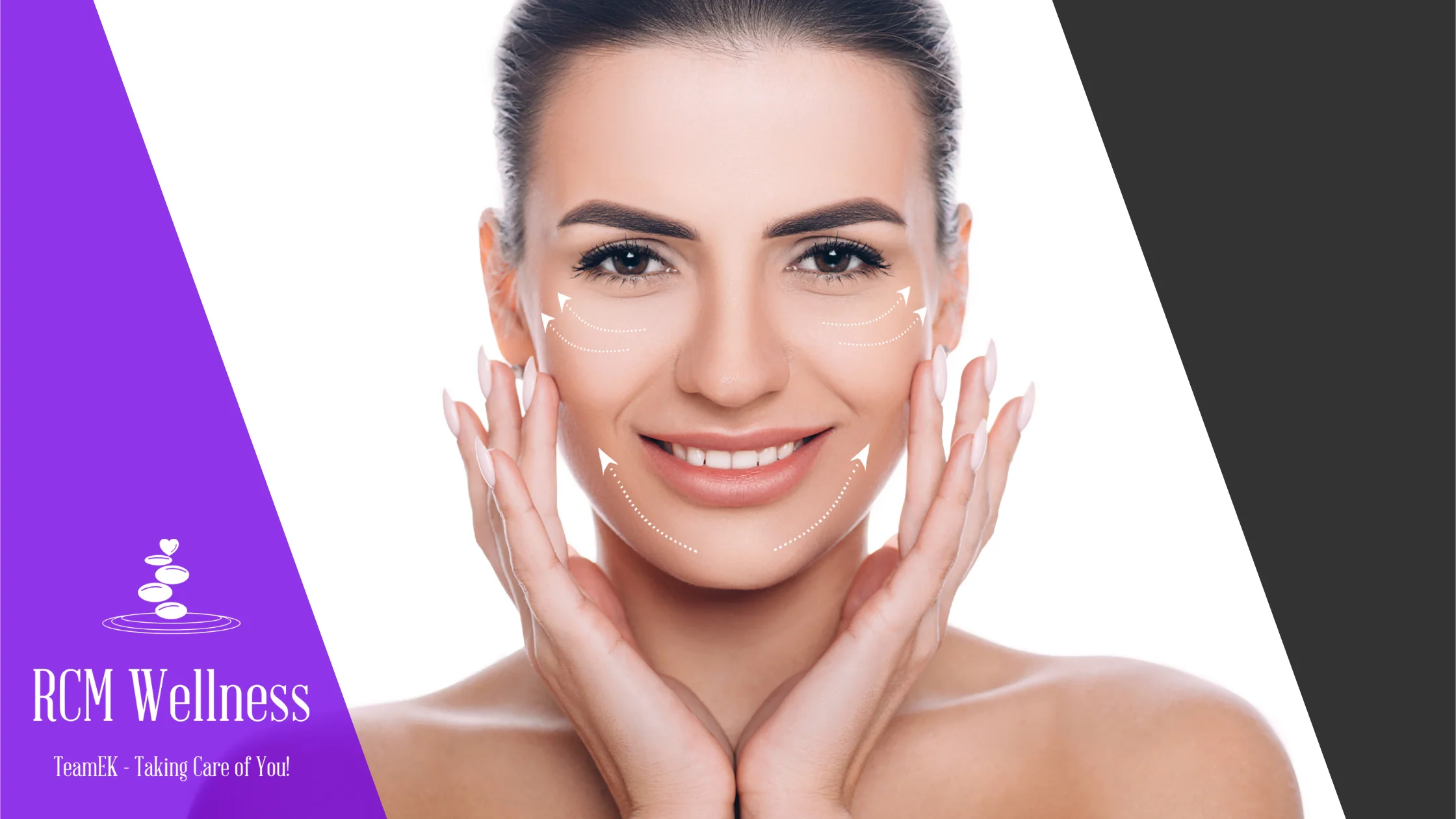 Face Lift Derma 2.0 Skin Boosters | RCM Wellness Centre