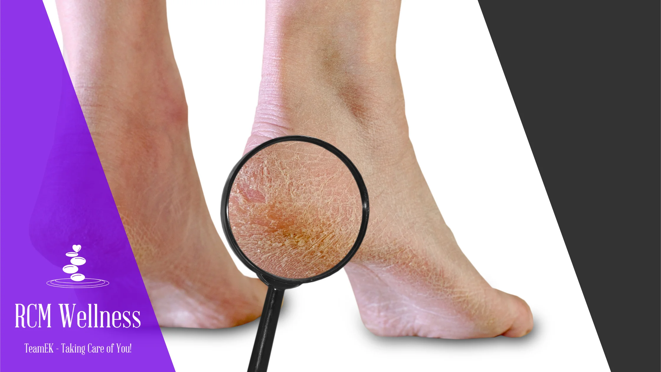 Podiatry Specialist - Foot, Ankle, Shin Care | RCM Wellness